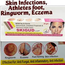 Skigud Cream 30g Fast Relief from Ringworm, Ezcema, Foot itching, & Sk