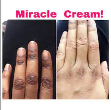 Quick Clear Remover Dark Knuckle Remover Dark Spot Corrector cream. Fa ...