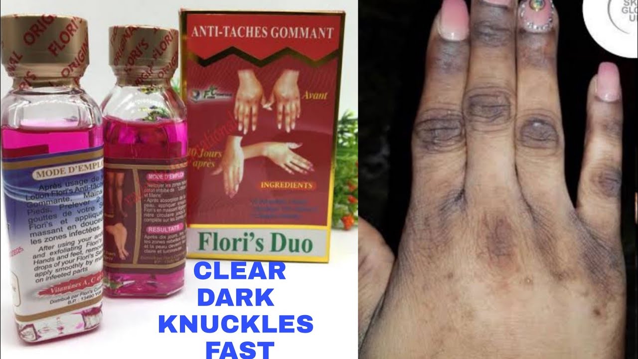 Flori's Duo Anti-Taches Set Liquid Lotion +Serum – Kismet Beauty Brands