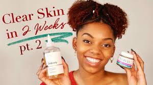 Nadinola Skin Discoloration Fade Cream Extra Strength 2.25 oz – Kismet ...